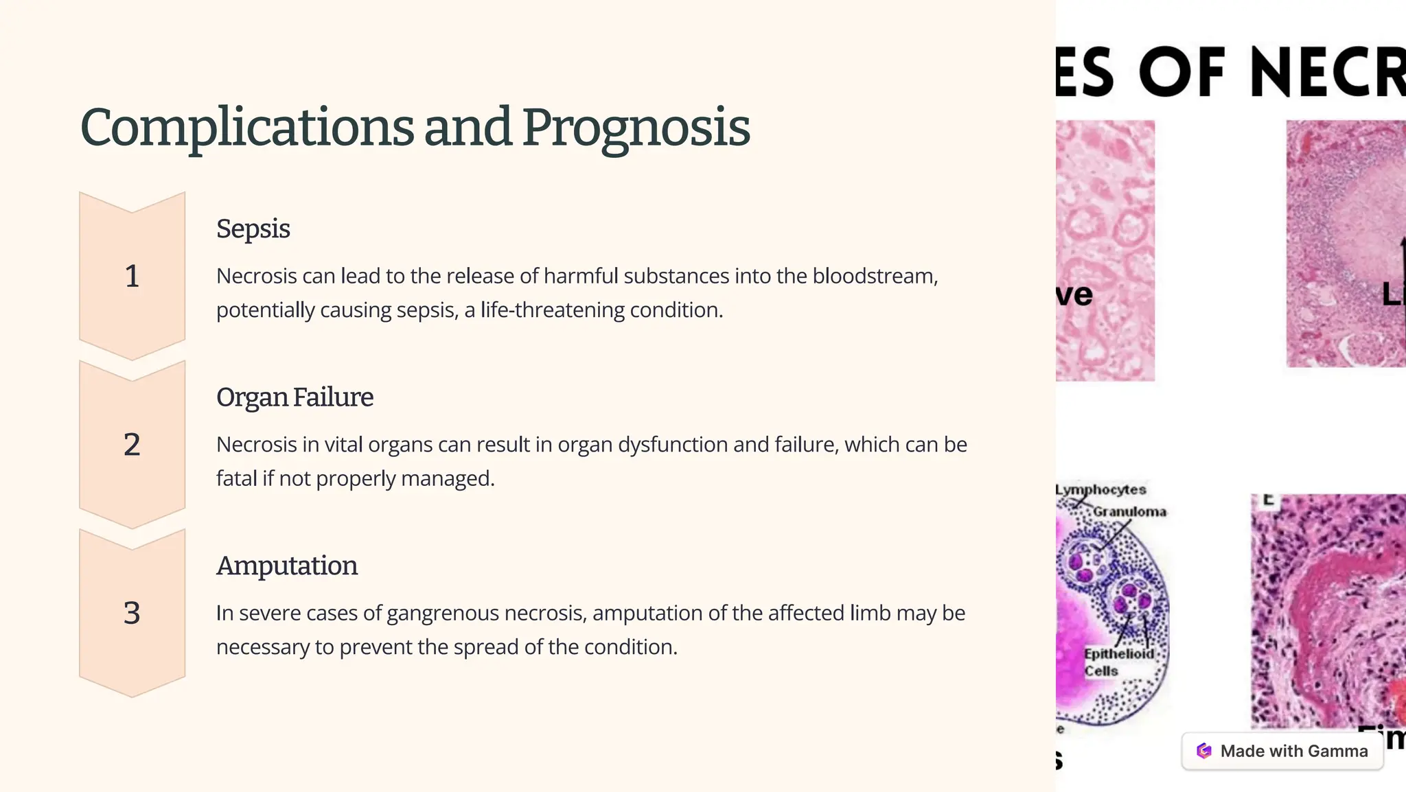 Introduction to Necrosis ,Cell death: necrosis, injury, infection. | PDF