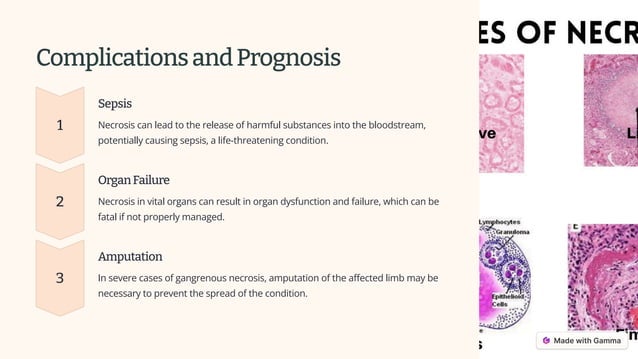 Introduction to Necrosis ,Cell death: necrosis, injury, infection. | PPT