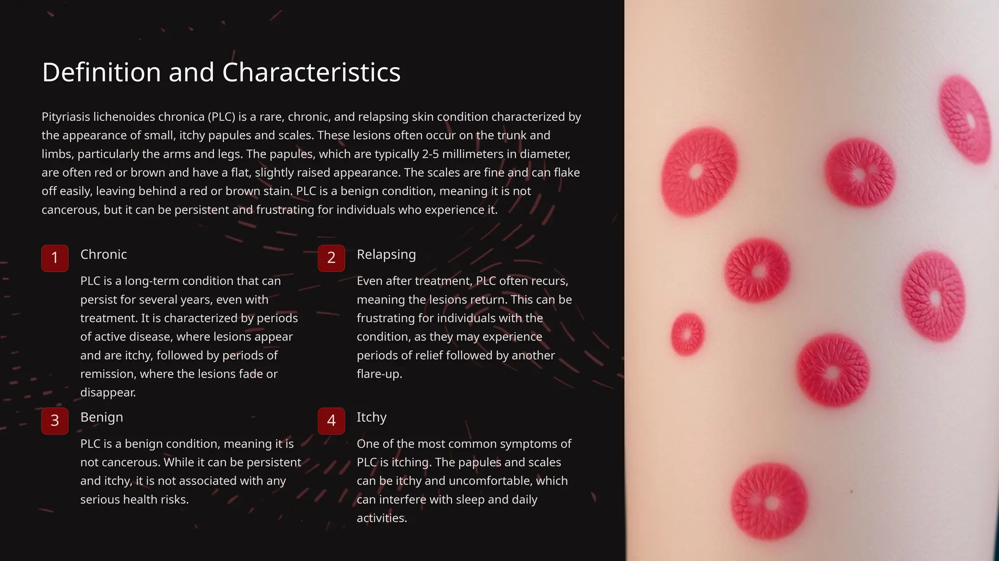 Introduction-to-Pityriasis-Lichenoides-Chronica.pptx