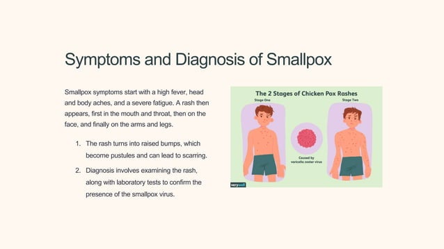 Epidemiology Prevention and control of Smallpox | PPTX