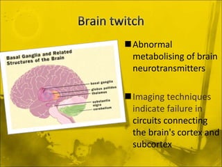 Introduction to Tourette Syndrome | PPT