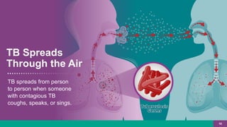 introduction-to-tuberculosis-508c.pptx