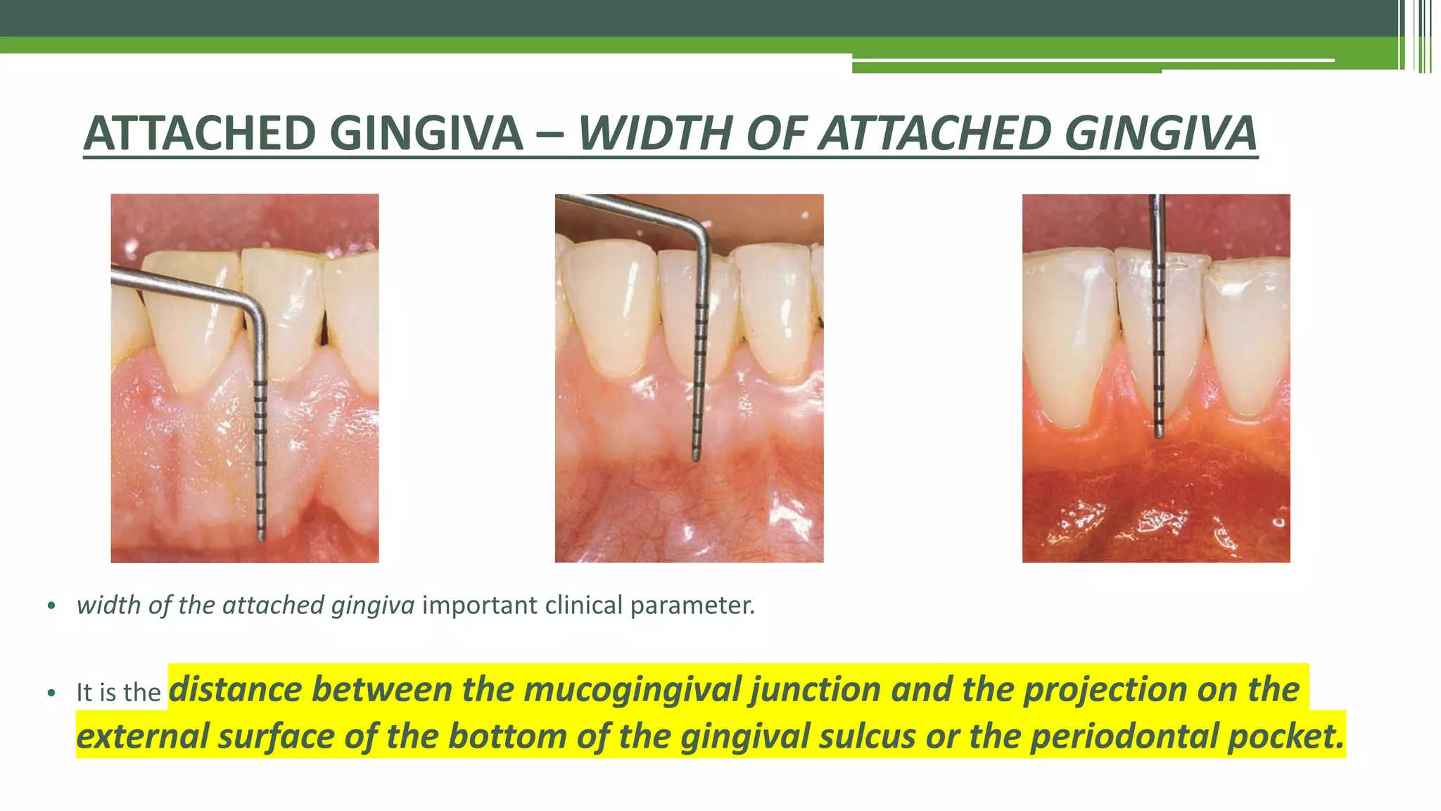 Clinical Periodontology - Introduction & Anatomy | PDF