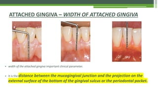Clinical Periodontology - Introduction & Anatomy | PDF