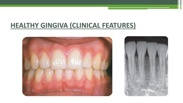 Clinical Periodontology - Introduction & Anatomy | PDF