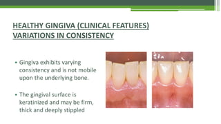 Clinical Periodontology - Introduction & Anatomy | PDF