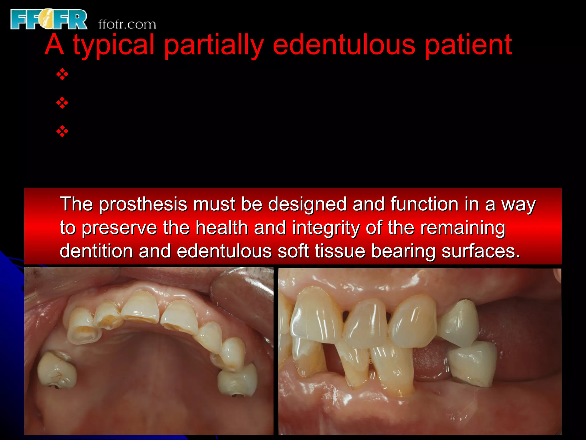 Introduction and basic components of rpd's copy | PPT