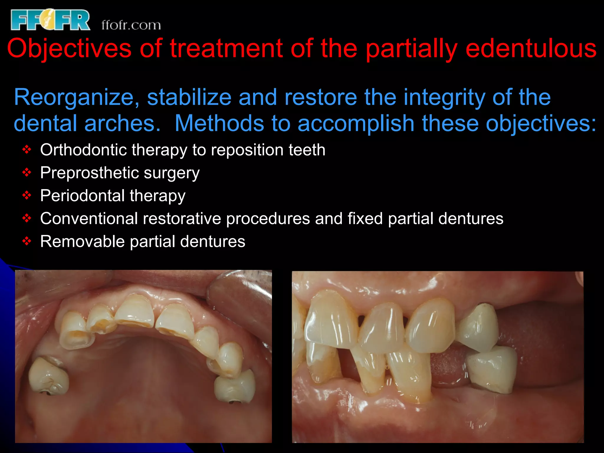 Introduction and basic components of rpd's copy | PPT
