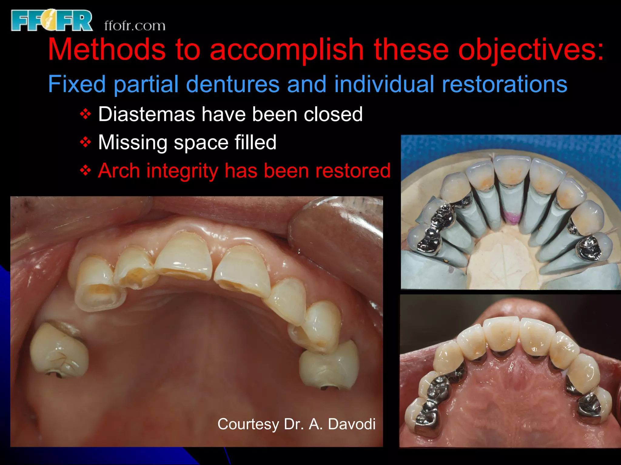 Introduction and basic components of rpd's copy | PPT