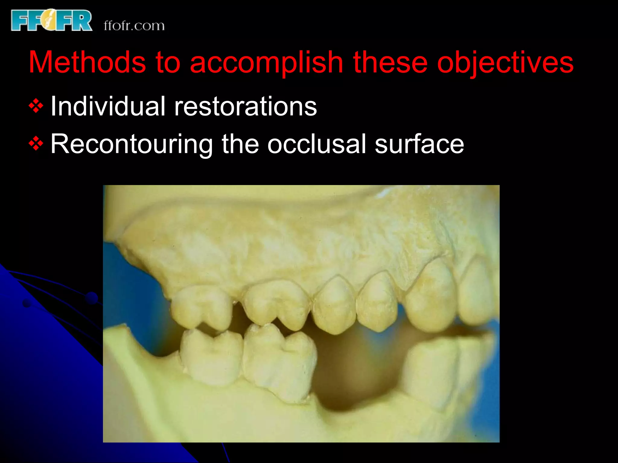 Introduction and basic components of rpd's copy | PPT