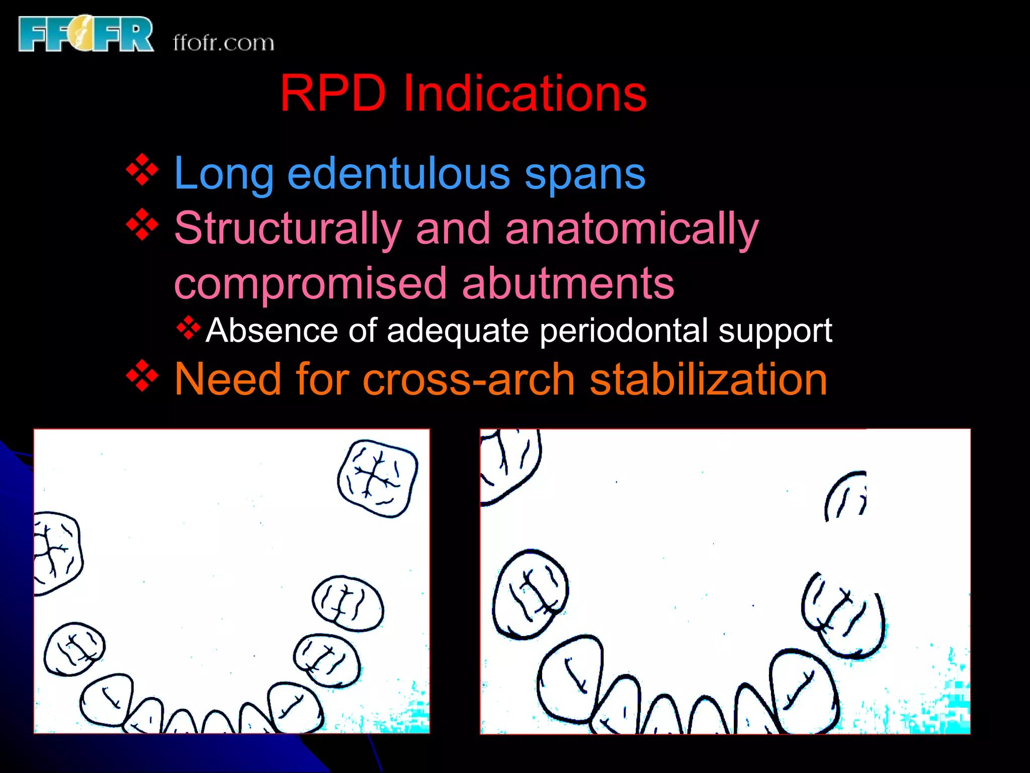 Introduction and basic components of rpd's copy | PPT