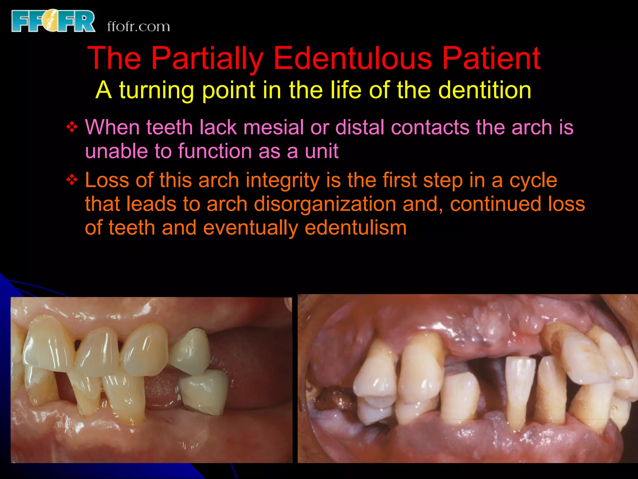 Introduction and basic components of rpd's copy | PPT