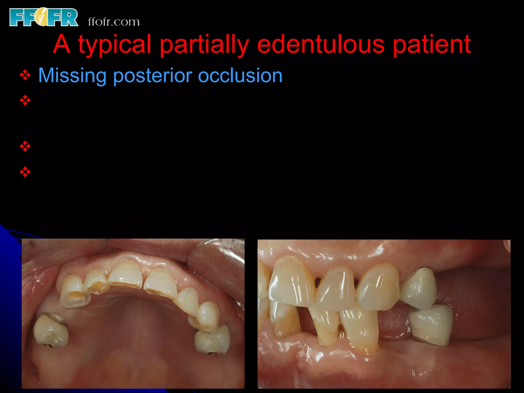 Introduction and basic components of rpd's copy | PPT