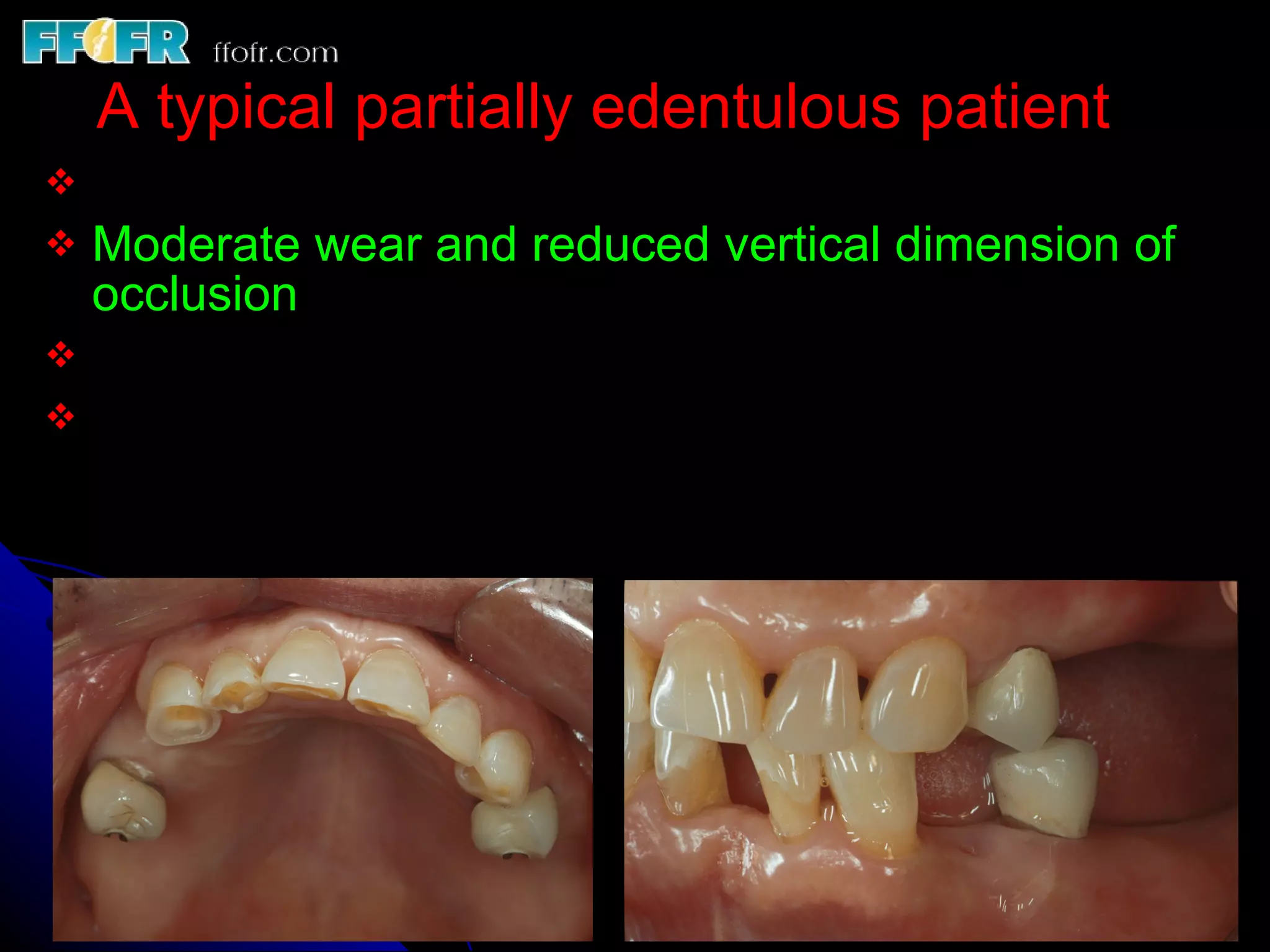 Introduction and basic components of rpd's copy | PPT