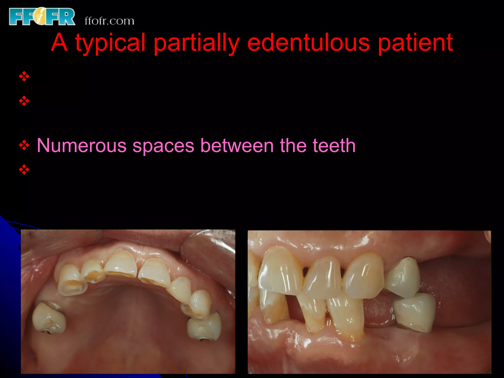 Introduction and basic components of rpd's copy | PPT