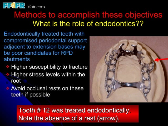 Introduction and basic components of rpd's copy | PPT | Dental Health ...