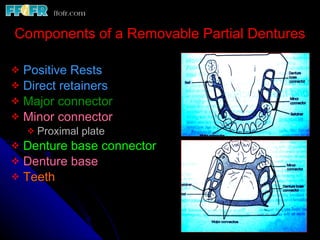 Introduction and basic components of rpd's copy | PPT