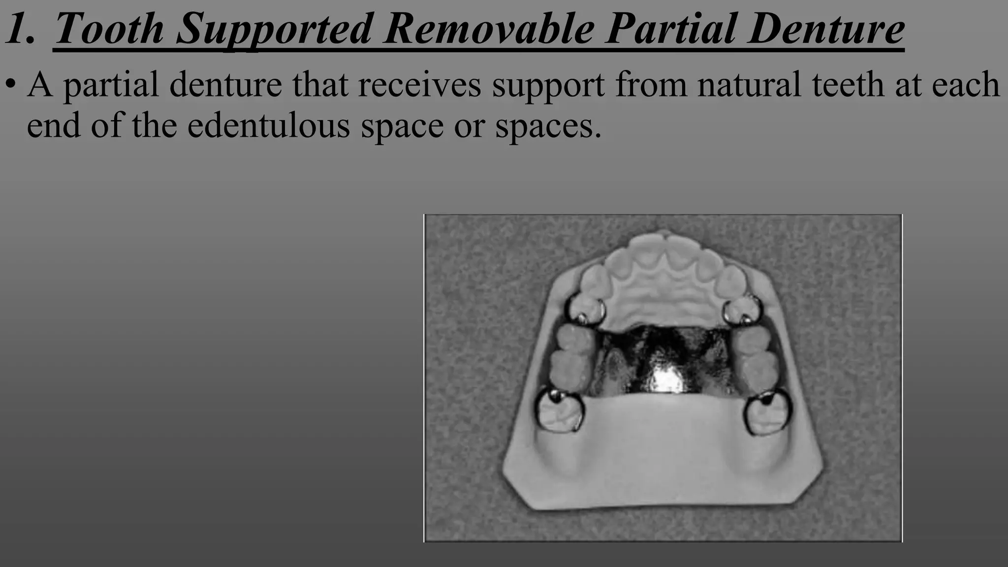Introduction and Classification RPD | PPTX