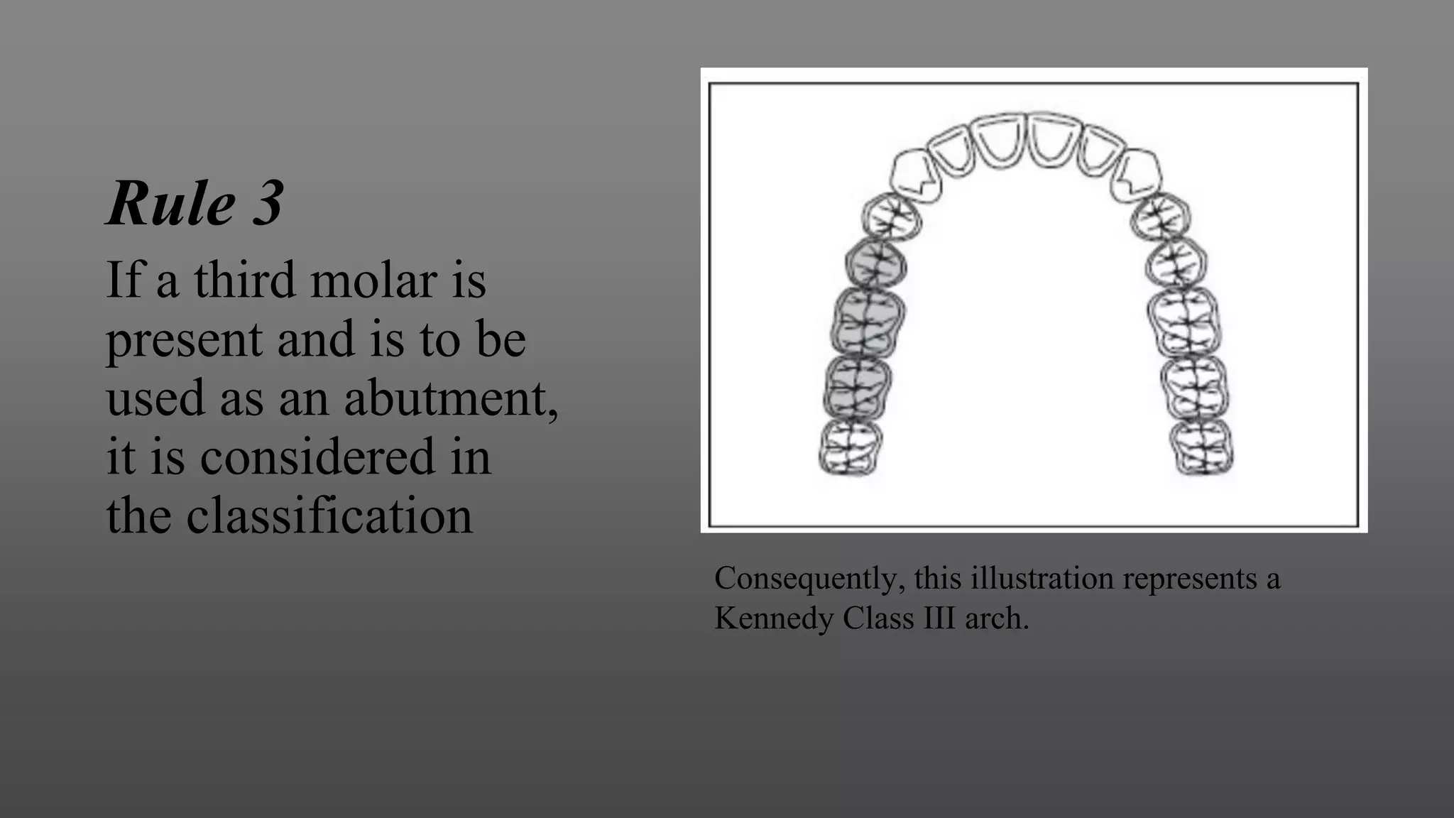 Introduction and Classification RPD | PPTX