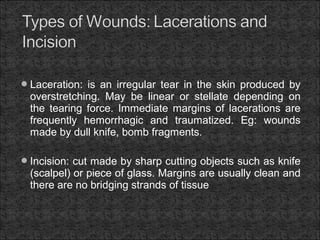 Classification of wounds | PPT | Death, Injury, or Military Conflict ...