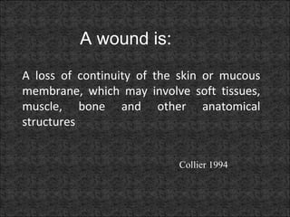 Classification of wounds | PPT