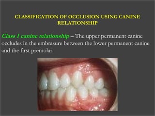 CLASSIFICATION OF NORMAL OCCLUSION AND MALOCCLUSION. | PPT