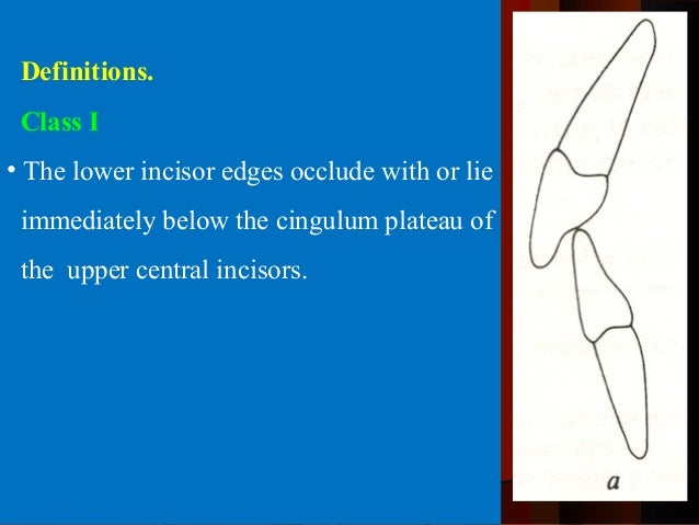 Classification Of Normal Occlusion And Malocclusion