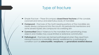Introduction to Mandibular Fracture .pptx