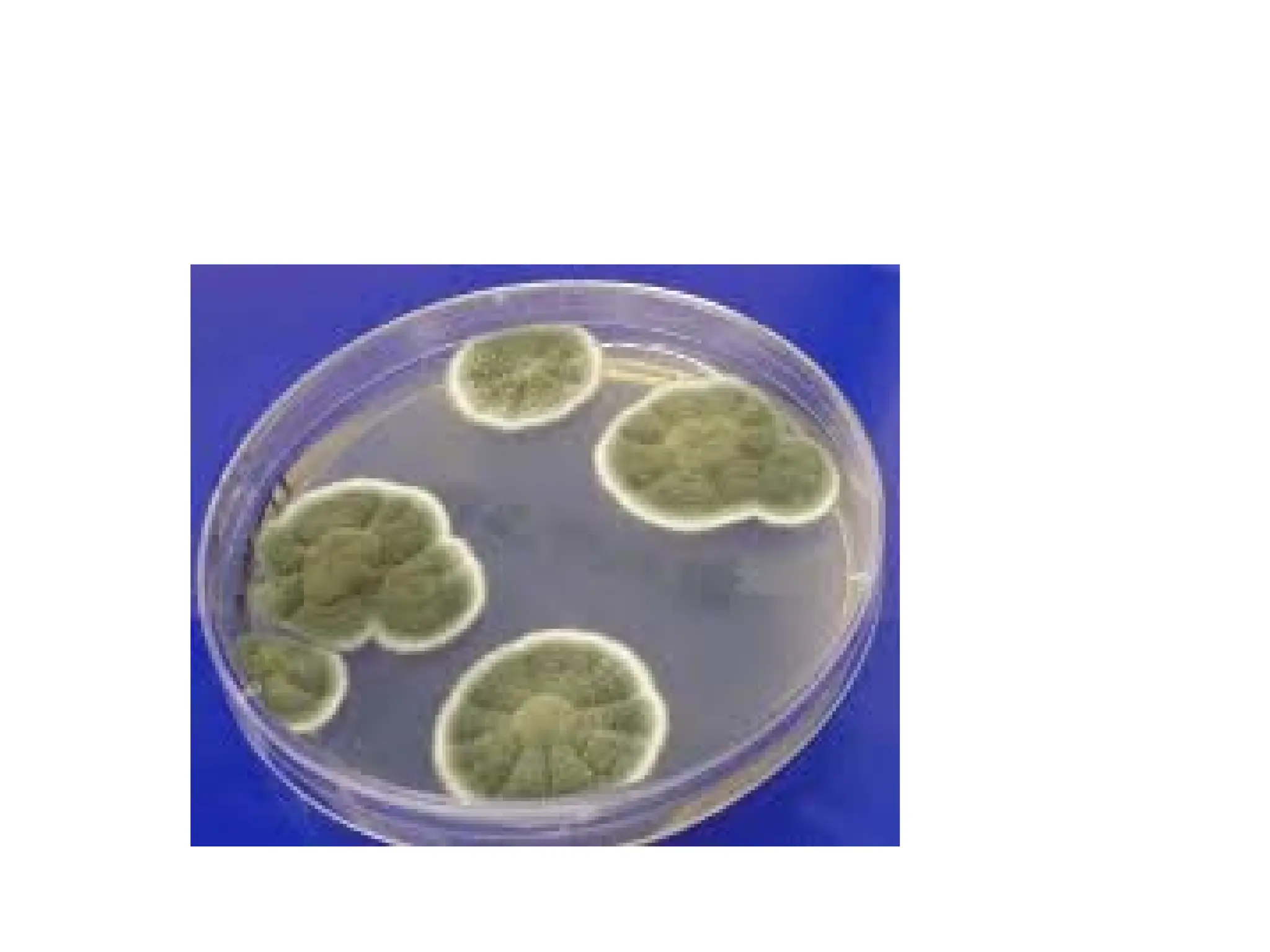 Introduction,classification and lab diagnosis in mycology.pptx