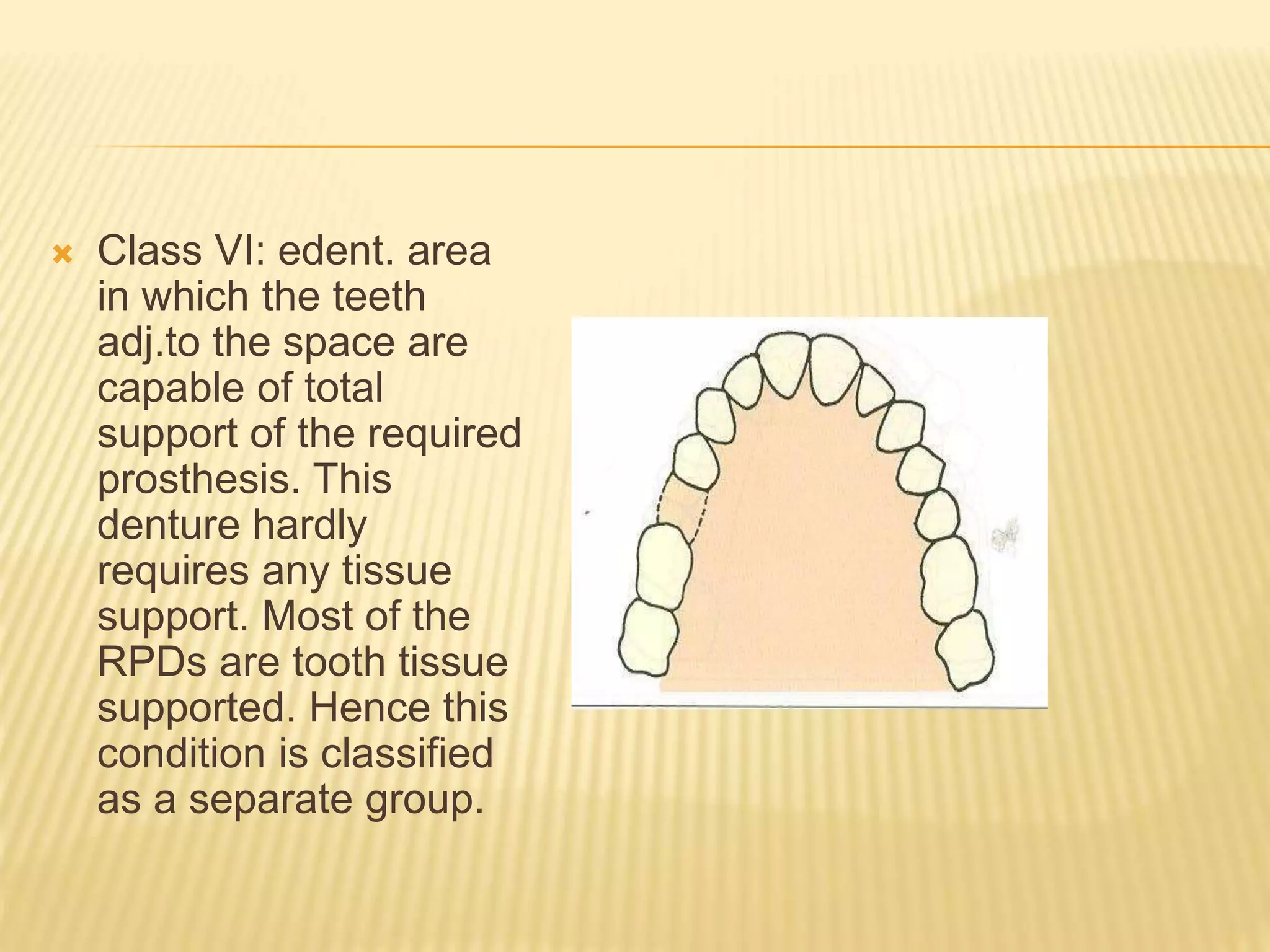 Introduction & classification of removable partial denture | PPTX