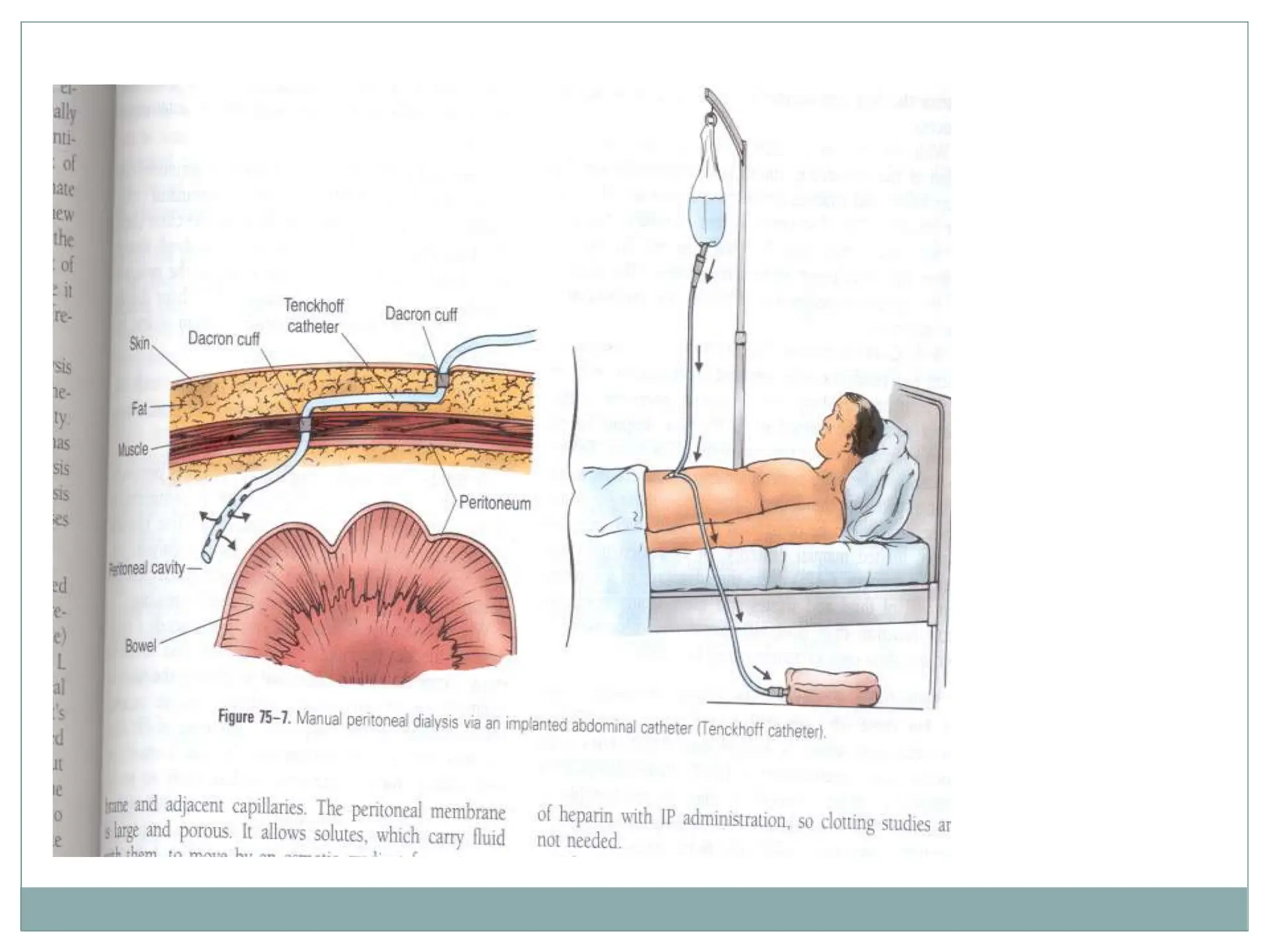 INTRODUCTION dialysis chapter types .pptx