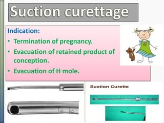 Introduction,dilataion and curretage&suction curetage | PPTX
