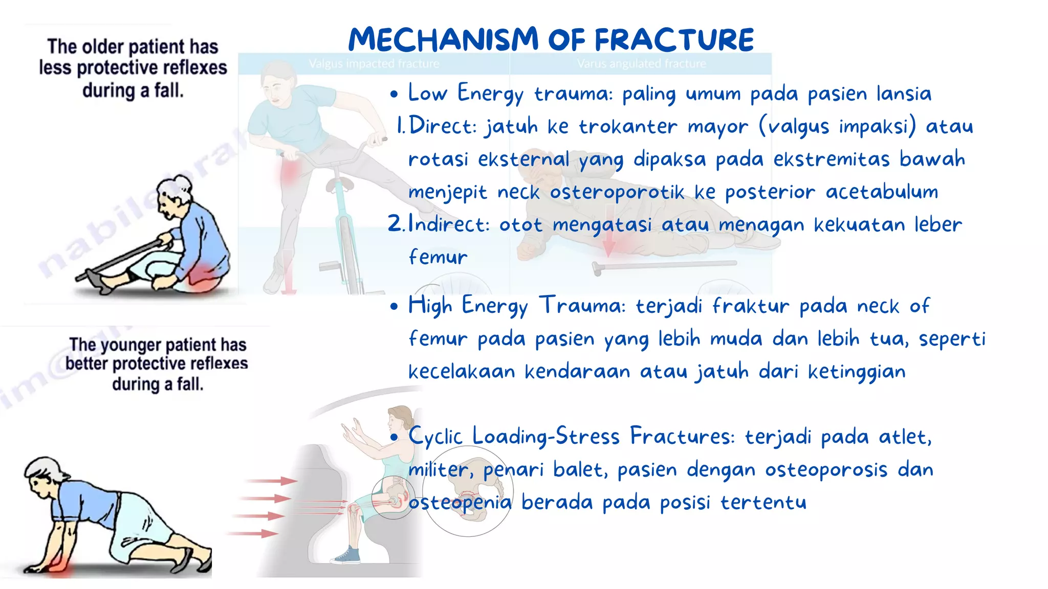 Introduction Hip Fracture_Putri Karina.pdf