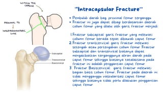 Introduction Hip Fracture_Putri Karina.pdf
