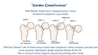 Introduction Hip Fracture_Putri Karina.pdf