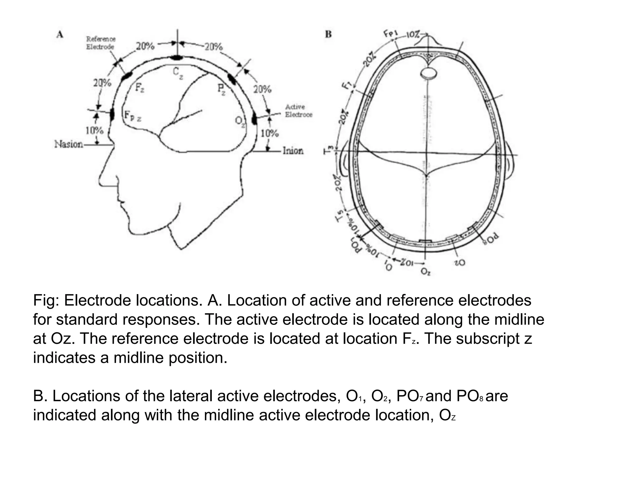 Introduction, history and neurophysiologic basis of vep | PPT