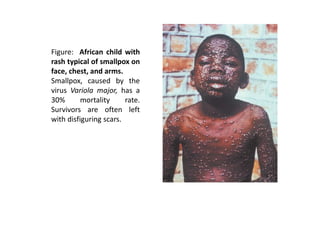 Introduction Immunology .pptx | Infectious Diseases | Diseases and ...