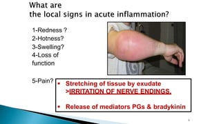 INTRODUCTION inflammation.pptx