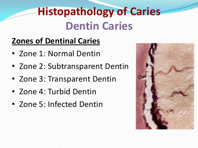 Introduction into operative dentistry.pdf mazen doumani