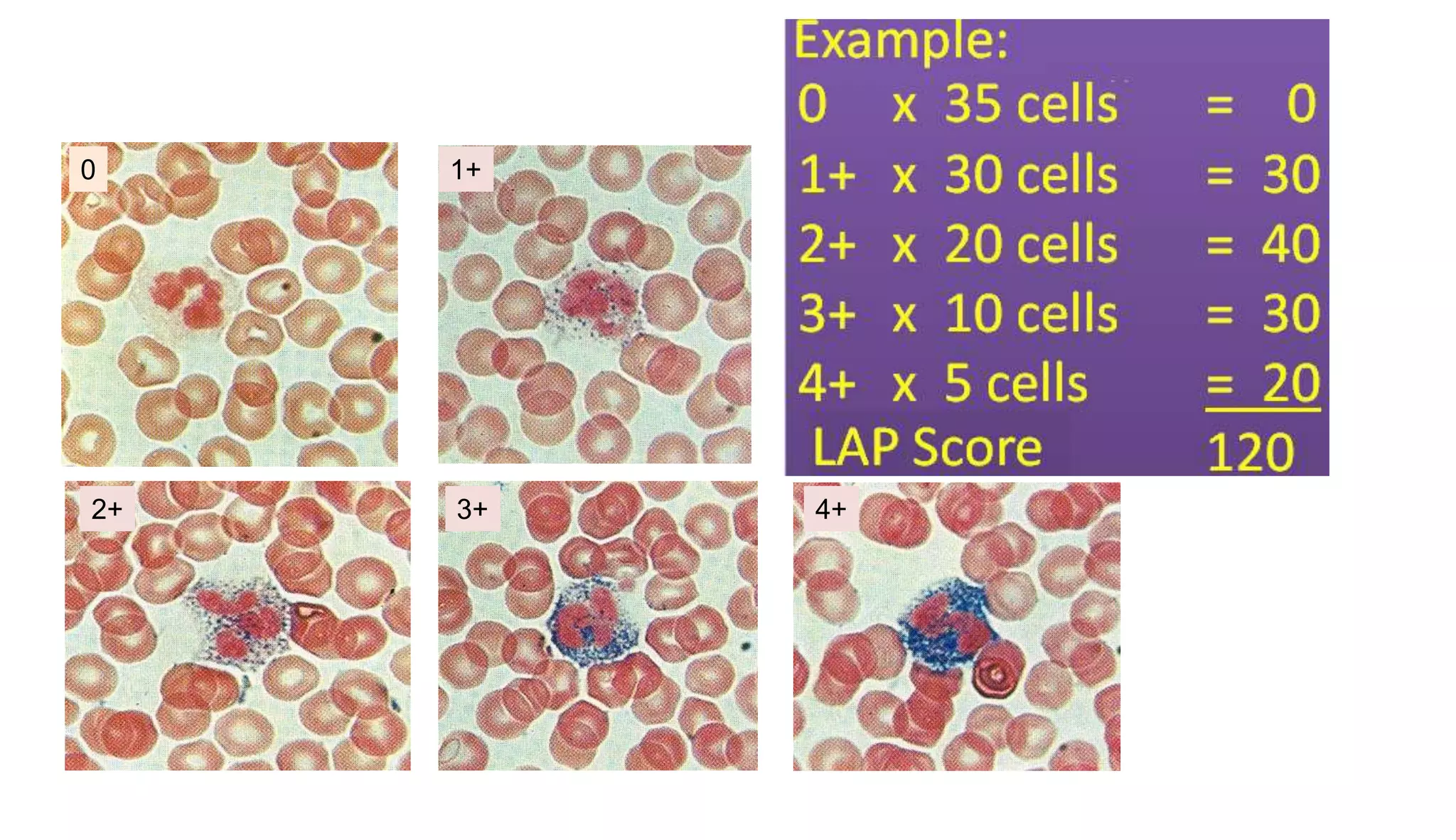 Introduction of Hematol.Malignancy .ppt