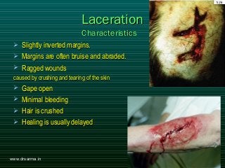 Introduction of injuries by abdinur | PPT