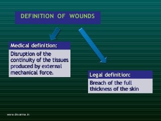 Introduction of injuries by abdinur | PPT