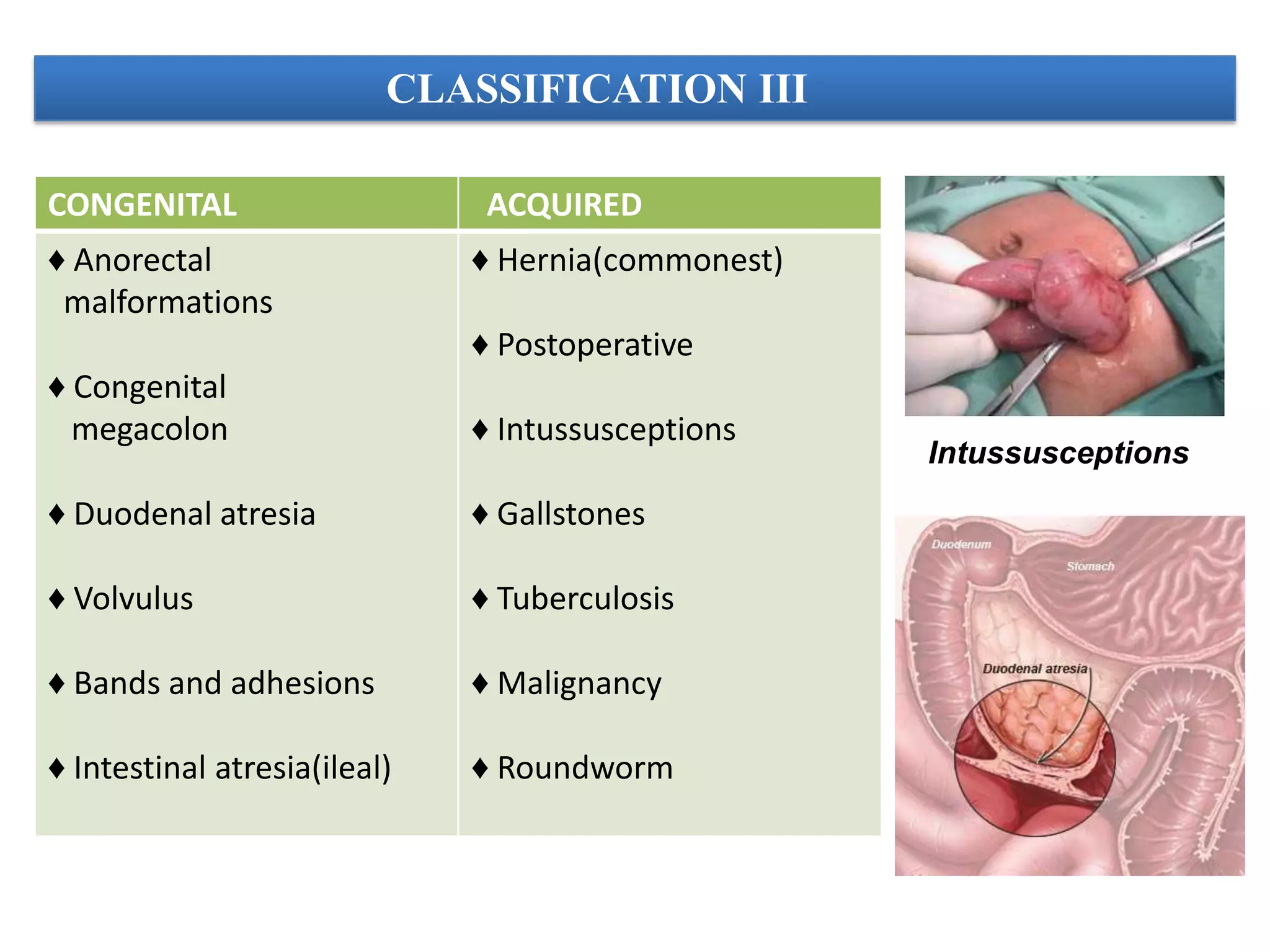 Introduction of intestinal obstruction Pallavi Shekhar Medical College ...