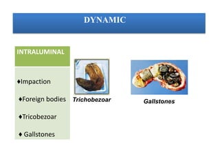 Introduction of intestinal obstruction Pallavi Shekhar Medical College ...