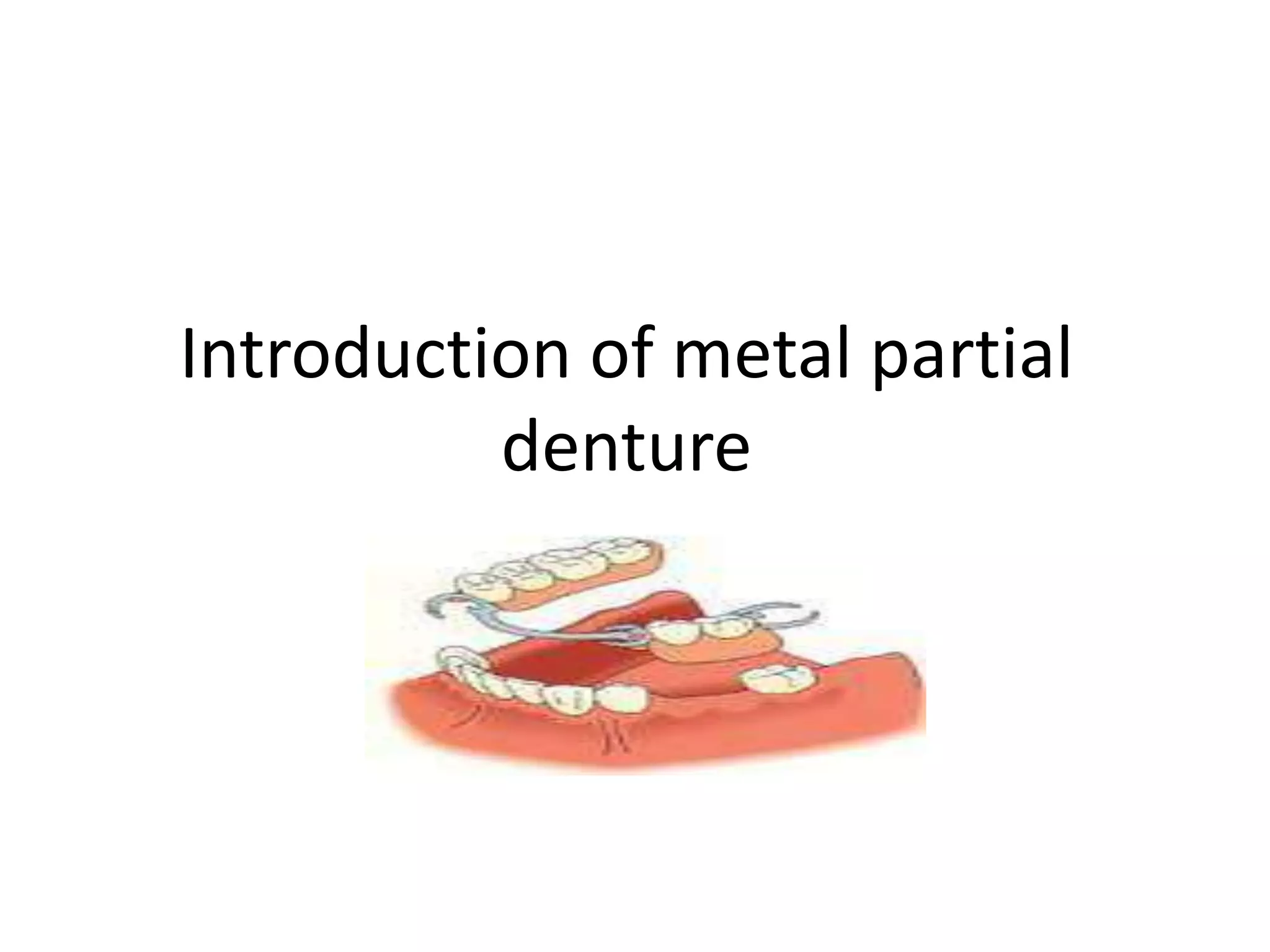 Introduction of metal partial denture.pptx