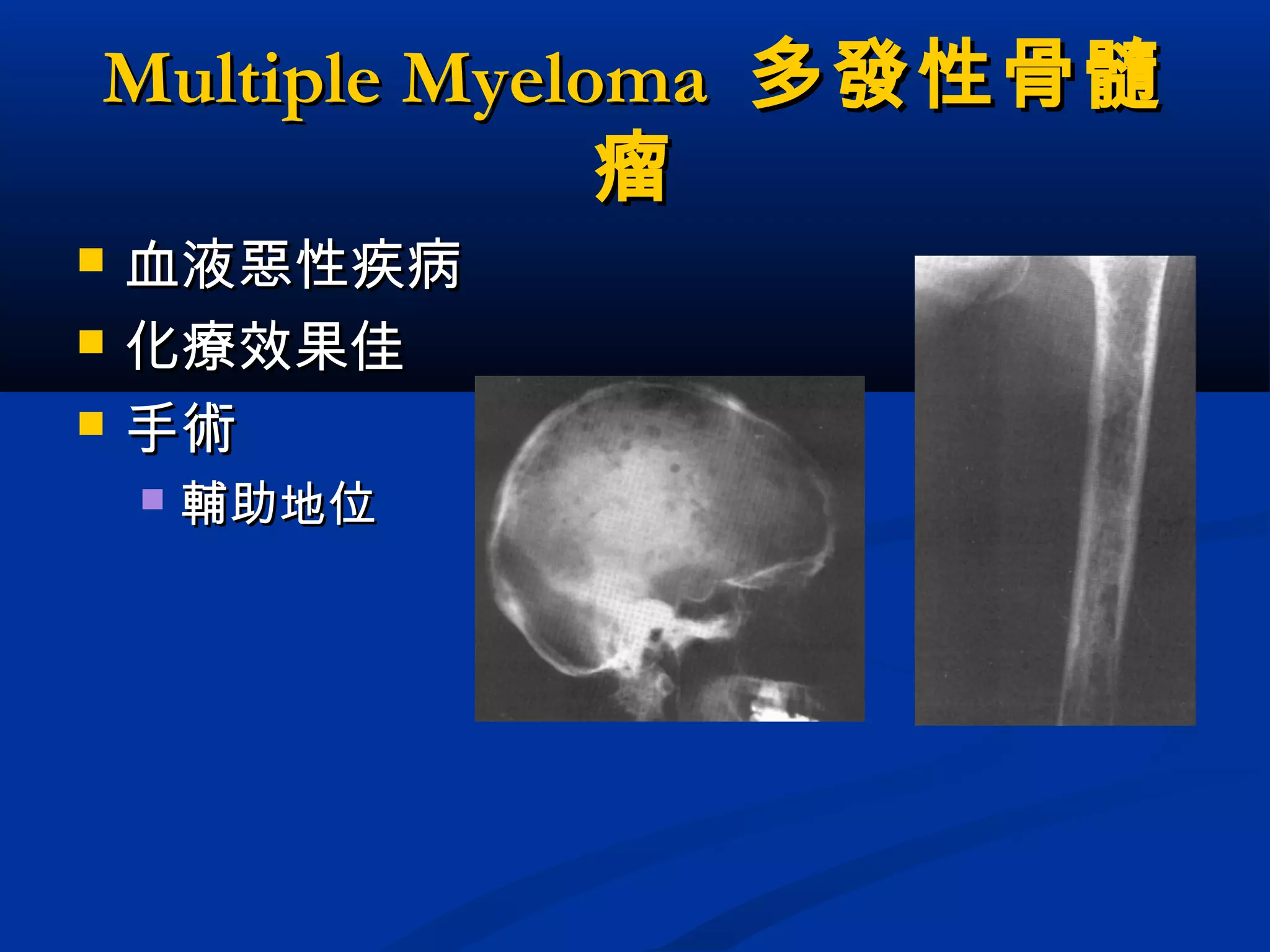 Introduction of musculoskeletal tumors | PPT