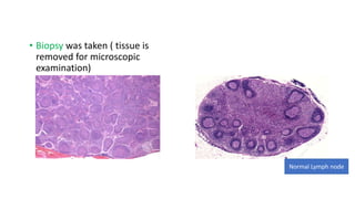 Introduction of pathology | PPTX