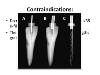 Introduction of saf system | PPTX