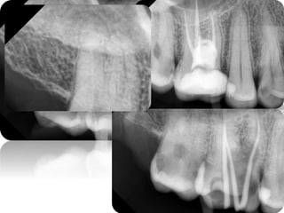 Introduction of saf system | PPTX