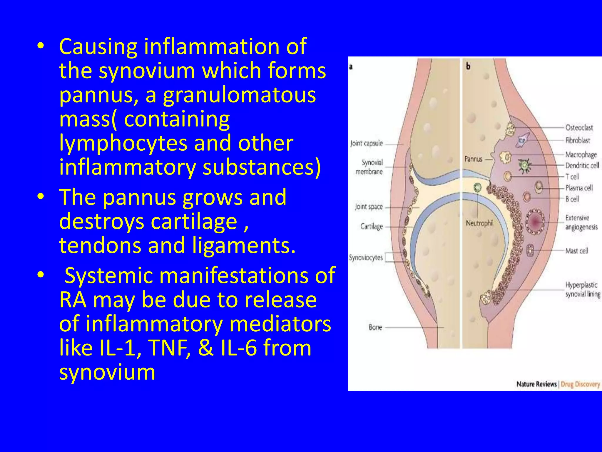 Introduction ,pathogenesis , clinical manifestations of rheumatoid | PPTX